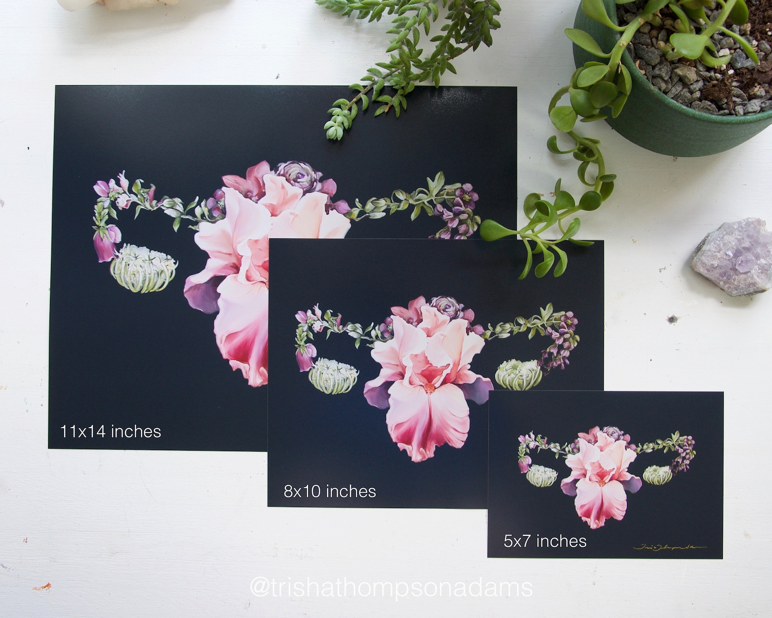 Floral Uterus Anatomy Print & Ready to Ship Dark Moody - Etsy