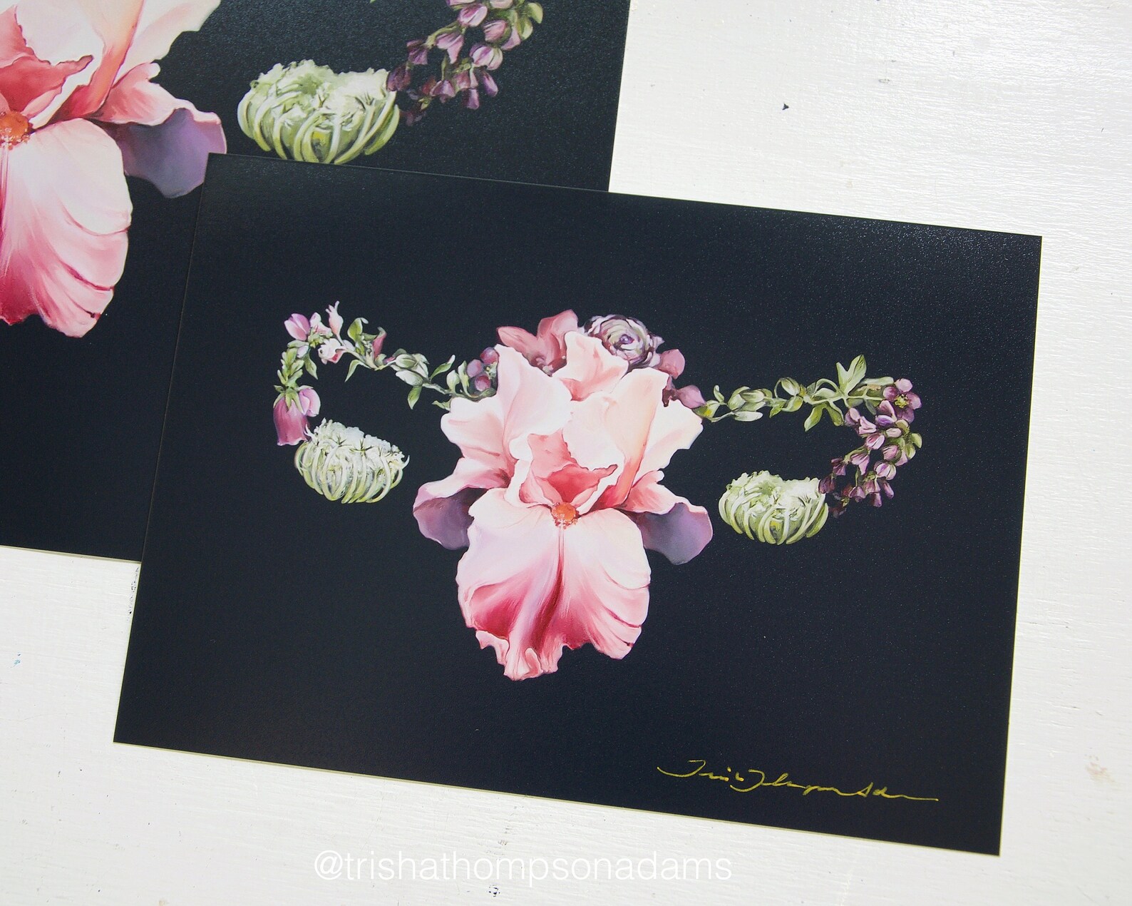 Floral Uterus Anatomy Print & Ready to Ship Dark Moody - Etsy