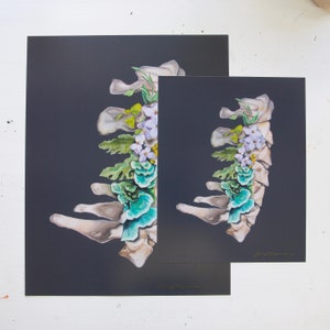 Floral Cervical Spine Vertebrae Print of Oil Painting - Anatomical Art ...