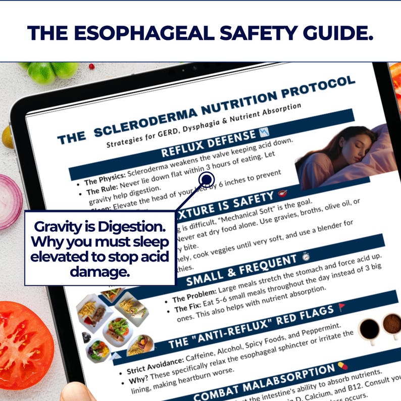 Scleroderma Food List & Dysphagia Diet – GERD Soft Food Guide, Systemic ...