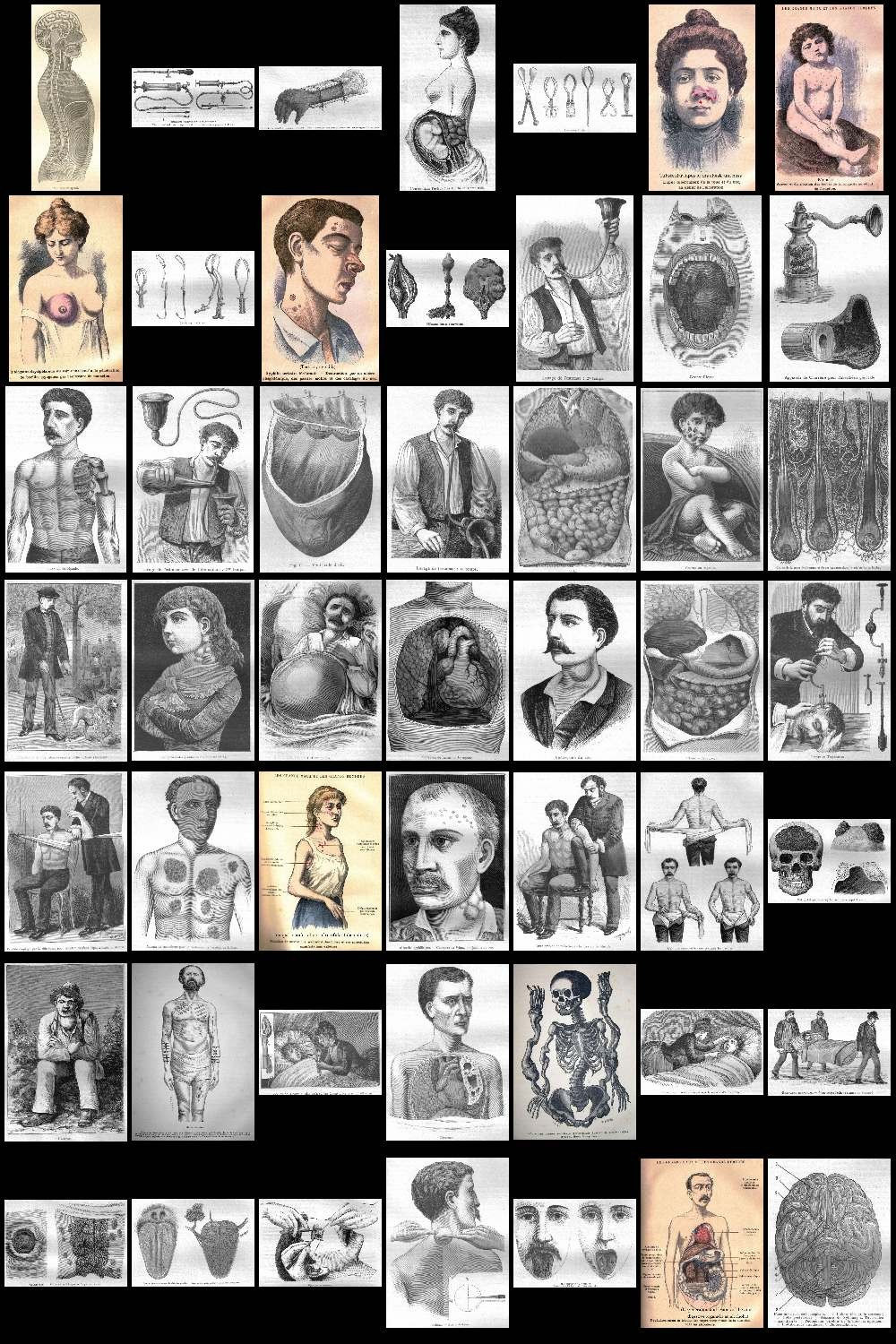 Digital Images Old Medical Illustration / Download Anatomical - Etsy