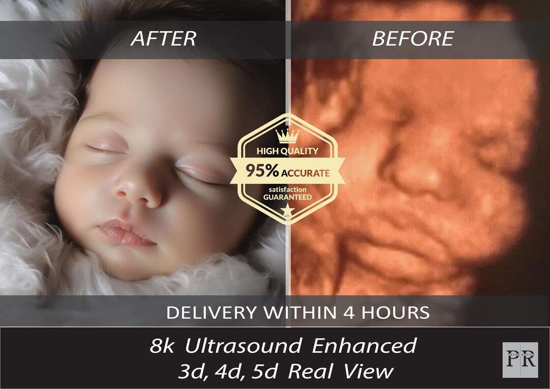 3D, 4D, 5D and HD Ultrasound | Real View | Ultrasound Baby | Ultrasound ...