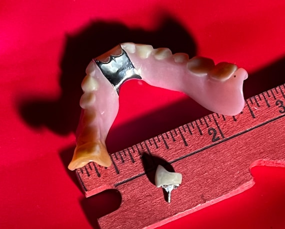 Someone Else’s Teeth Bottom Dentures - Gem