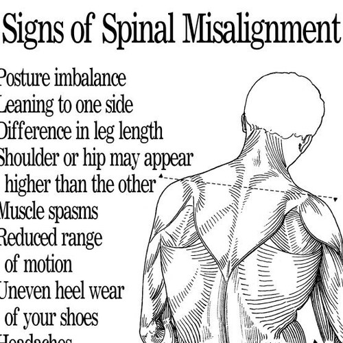 Signs of Spinal Misalignment Poster 18 X 24 - Etsy UK Signs of Spinal Misalignment Poster 18 X 24 - Etsy UK