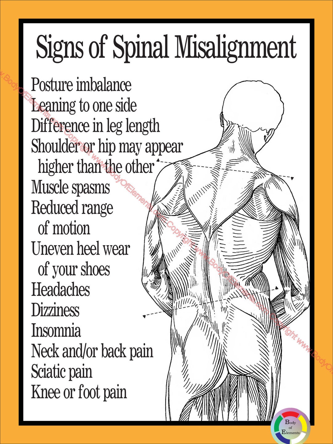 Signs of Spinal Misalignment Chiropractic Patient Education Poster 18 ...