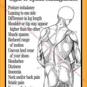Signs of Spinal Misalignment Chiropractic Patient Education Poster 18 ...