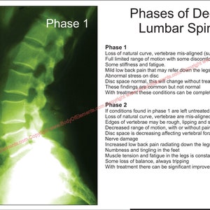 Lumbar Spinal Vertebrae Disc Degeneration Chiropractic Poster - 18" X ...