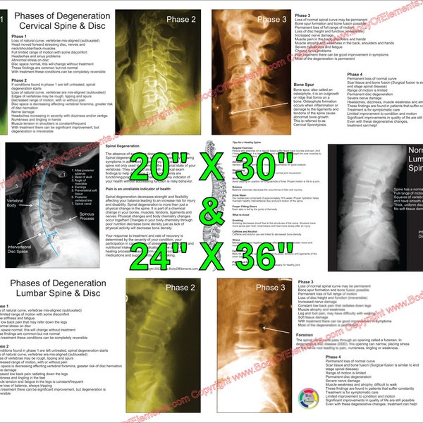 Chiropractic Spinal Degeneration Poster - Etsy