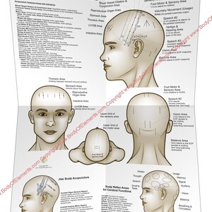 Scalp Acupuncture Points Areas Poster 18" X 24" Chinese Medicine TCM ...
