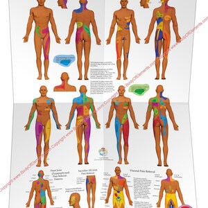 Sclerotome Visceral Pain Referral Chiropractic Poster 18" X 24 ...