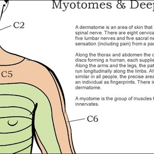 Póster de dermatomas, miotomas y DTR. Cuadro quiropráctico del sistema ...