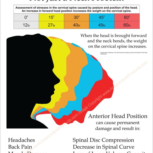 Text Neck Syndrome Poster - Etsy