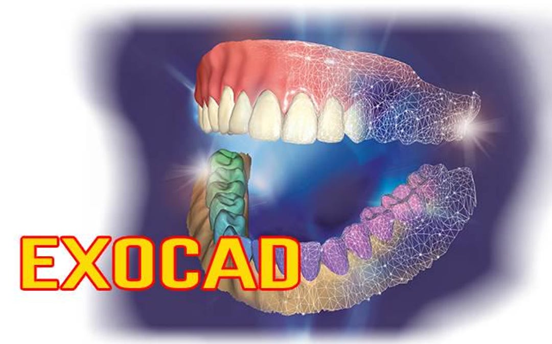 EXOCAD Dentalcad 3.2 Elefsina | Digital Dental Design Software | CAD ...