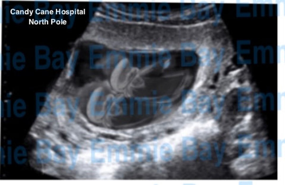 Christmas Baby Elf Twin Scan Picture - Etsy