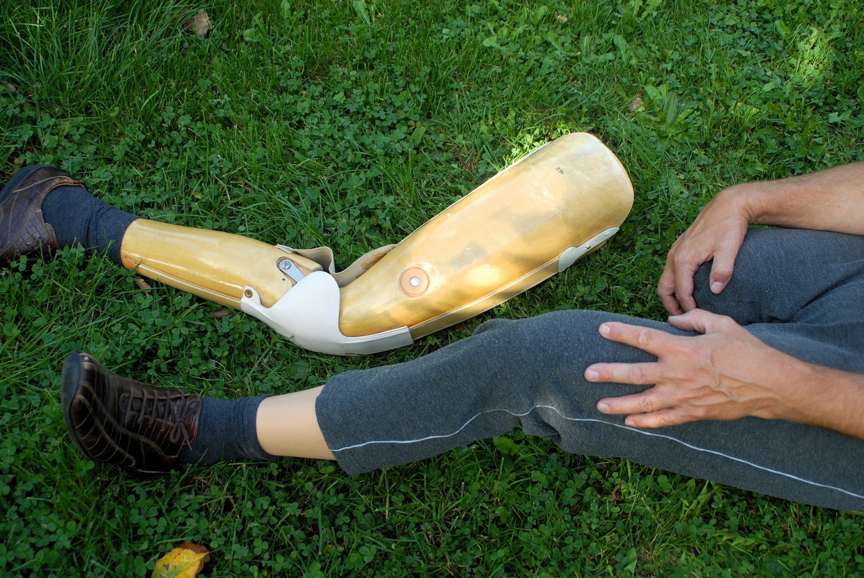 Very Nice Right German Mens Wooden Leg Prosthetic Leg Above Knee ...