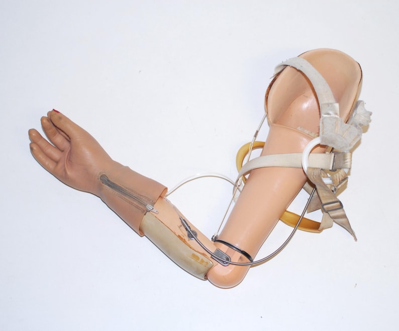 Rare Vintage 1990s German Womens Prosthetic Arm Resin With Cableworked ...