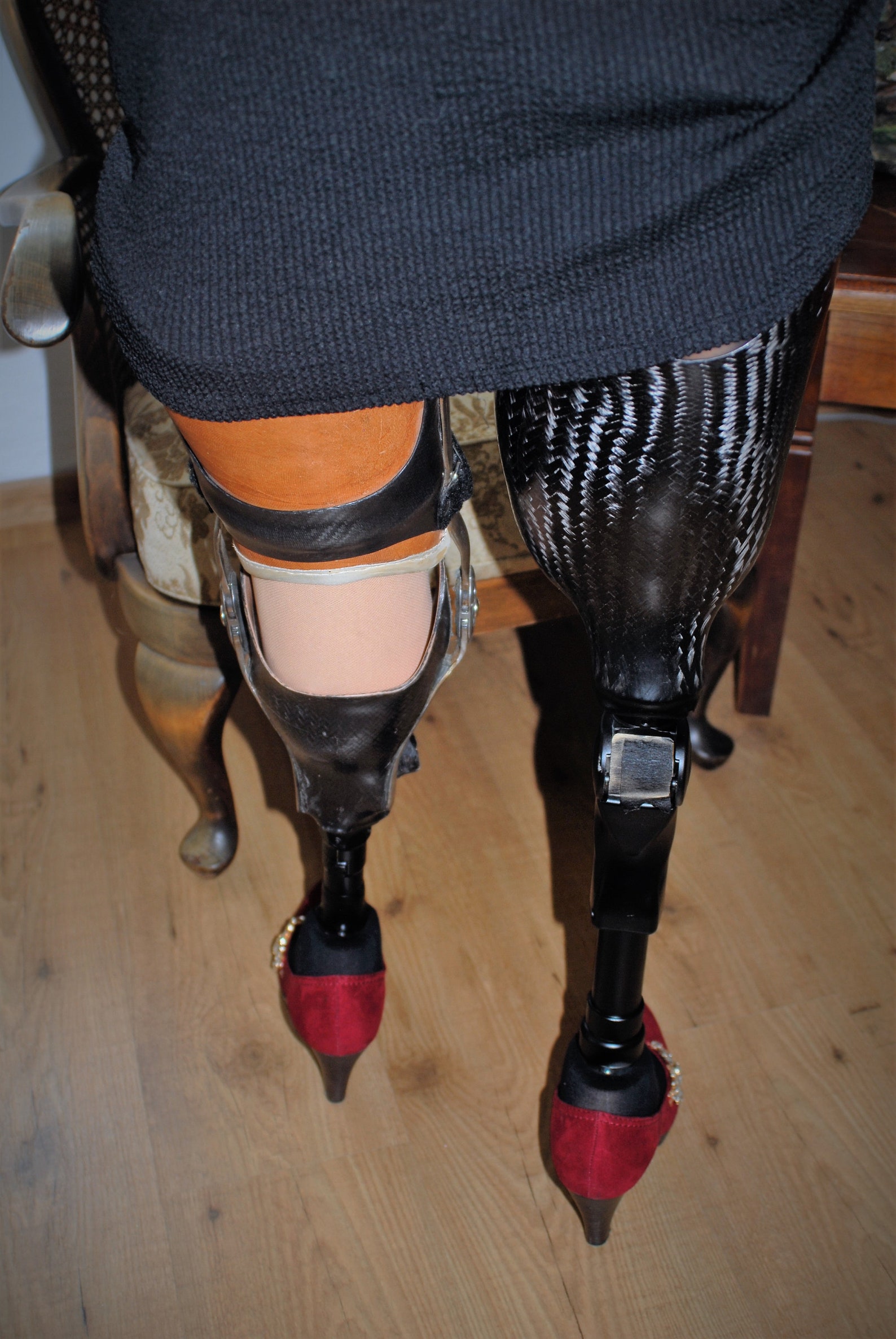 Vintage Rare Pair of Womens Prosthetic Leg Double Leg Amputee - Etsy UK