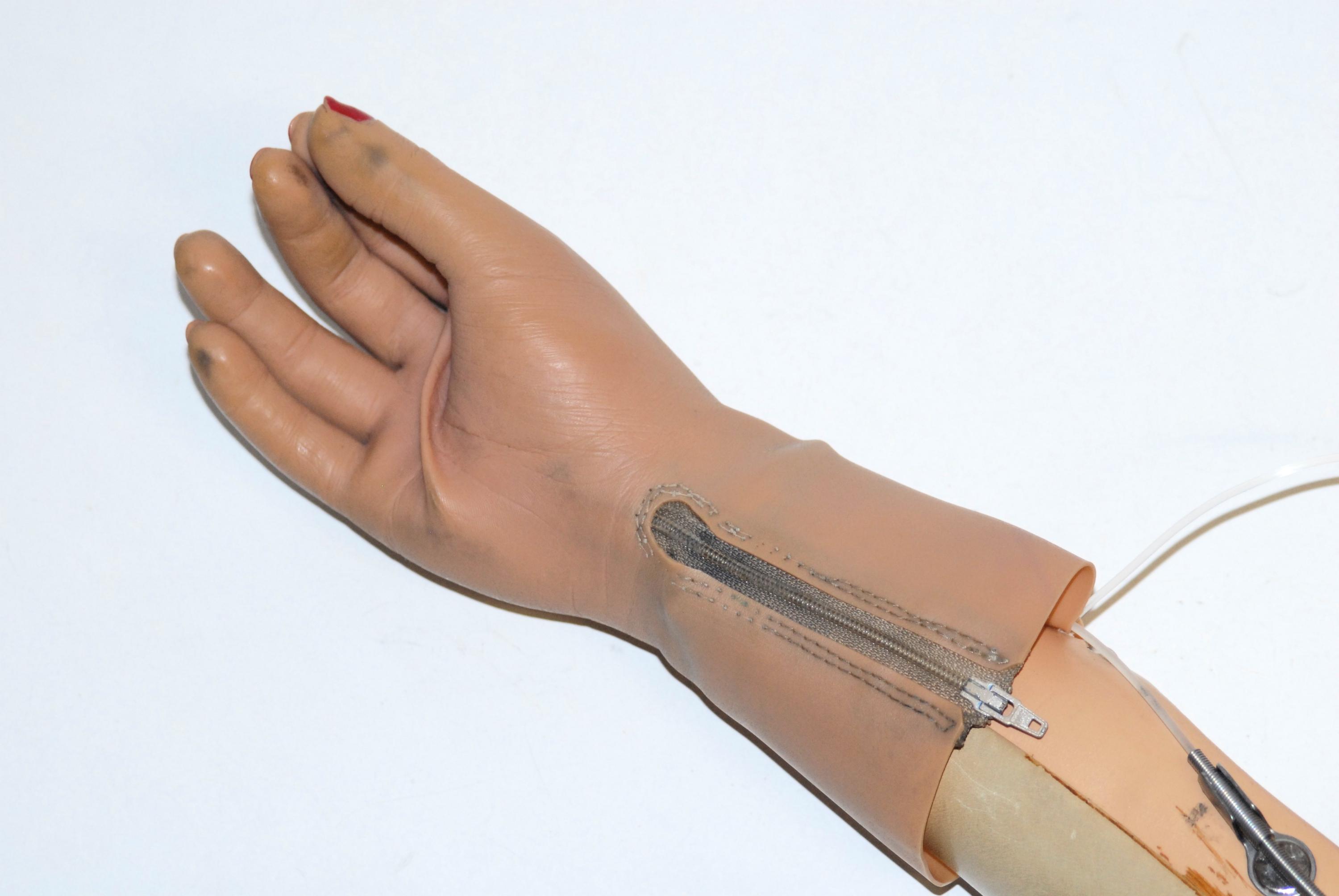 Rare Vintage 1990s German Womens Prosthetic Arm Resin With Cableworked ...