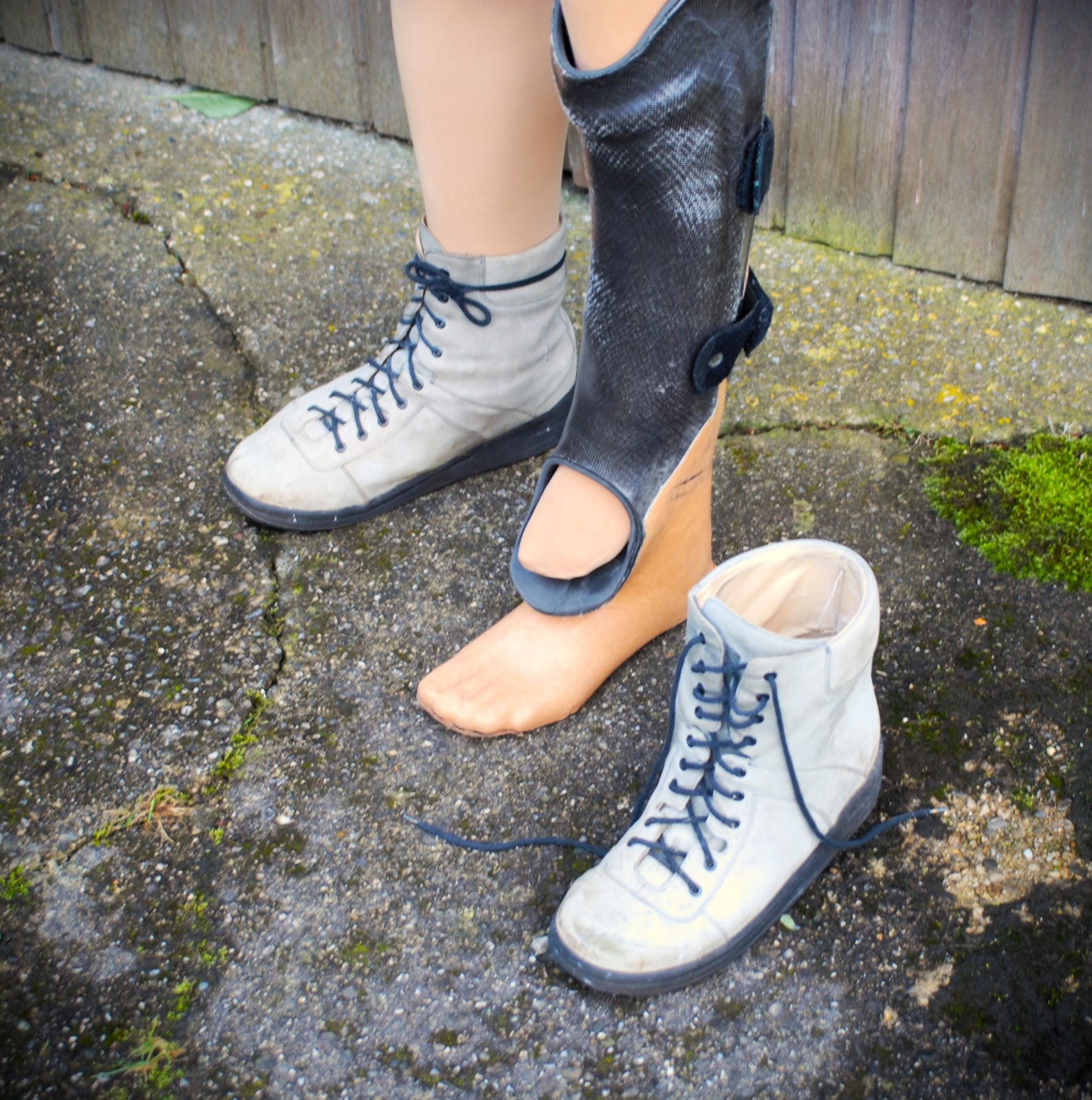 Extremely Rare Early 2000s Carbon AFO Polio Short Leg Brace With ...