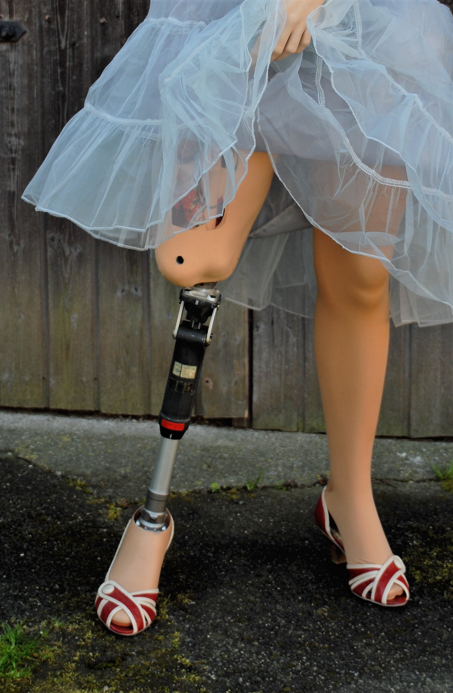 Vintage Rare Womens Contergan Shortleg Prosthetic Leg Above Knee ...