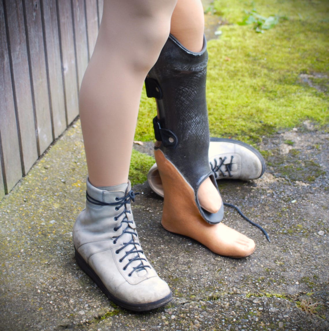 Extremely Rare Early 2000s Carbon AFO Polio Short Leg Brace With ...