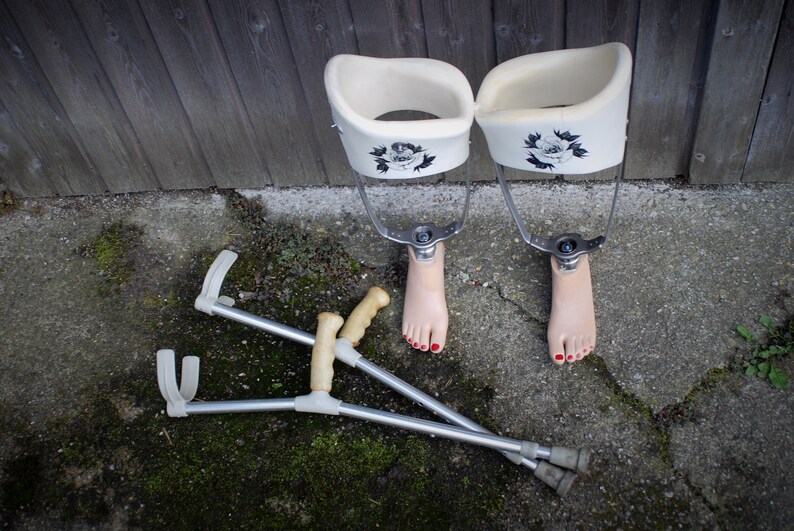 Rare Pair of Womens First Stubbies Stubby Interims Prosthetic - Etsy UK