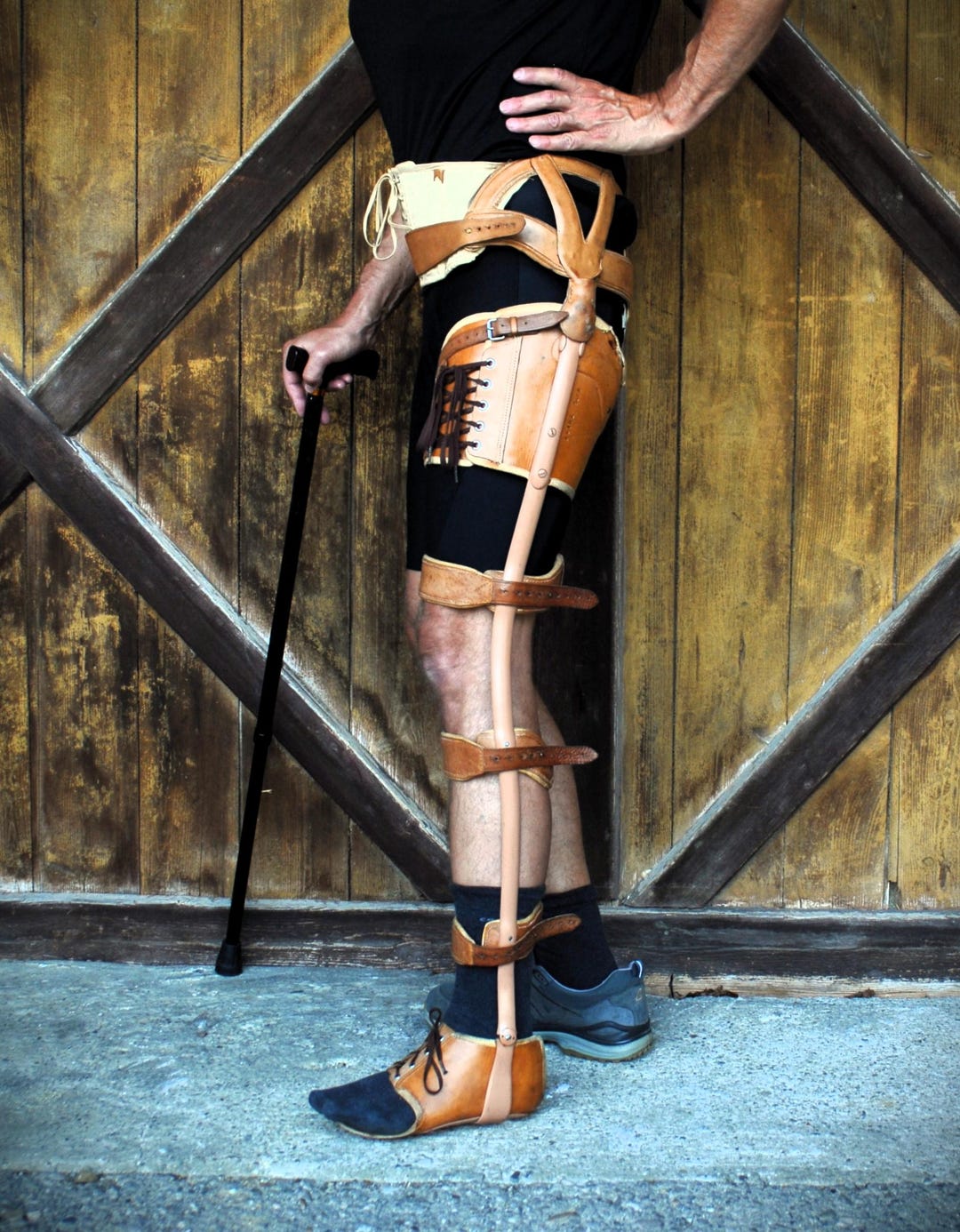 Extraordinary Rare Large / XL Early 1960s HKAFO KAFO and Corset Polio ...