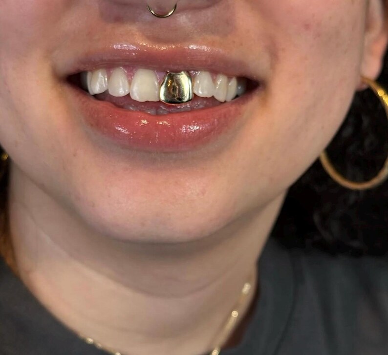 Custom Fitted Gold or Silver Single Tooth Grillz - Etsy
