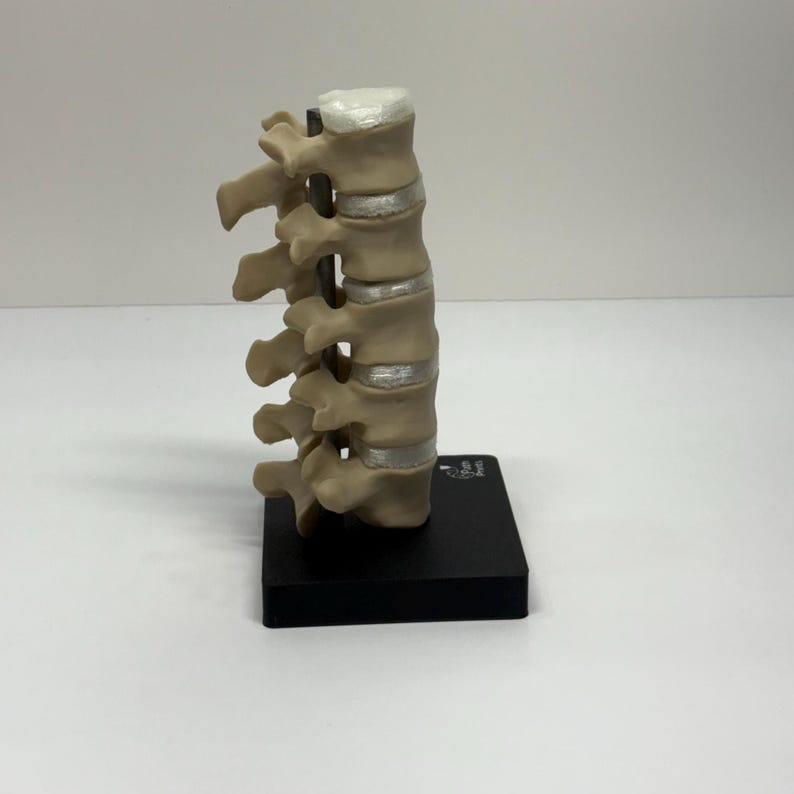 3D Printed Modular Lumbar Spine Model – Life-size L1-L5 Vertebrae - Etsy