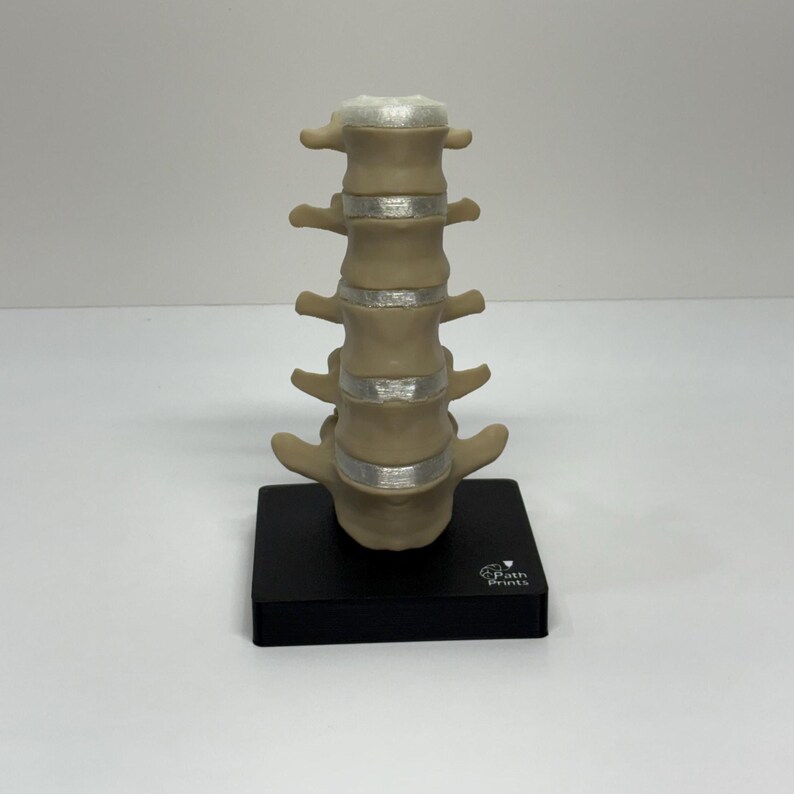 3D Printed Modular Lumbar Spine Model – Life-size L1-L5 Vertebrae - Etsy