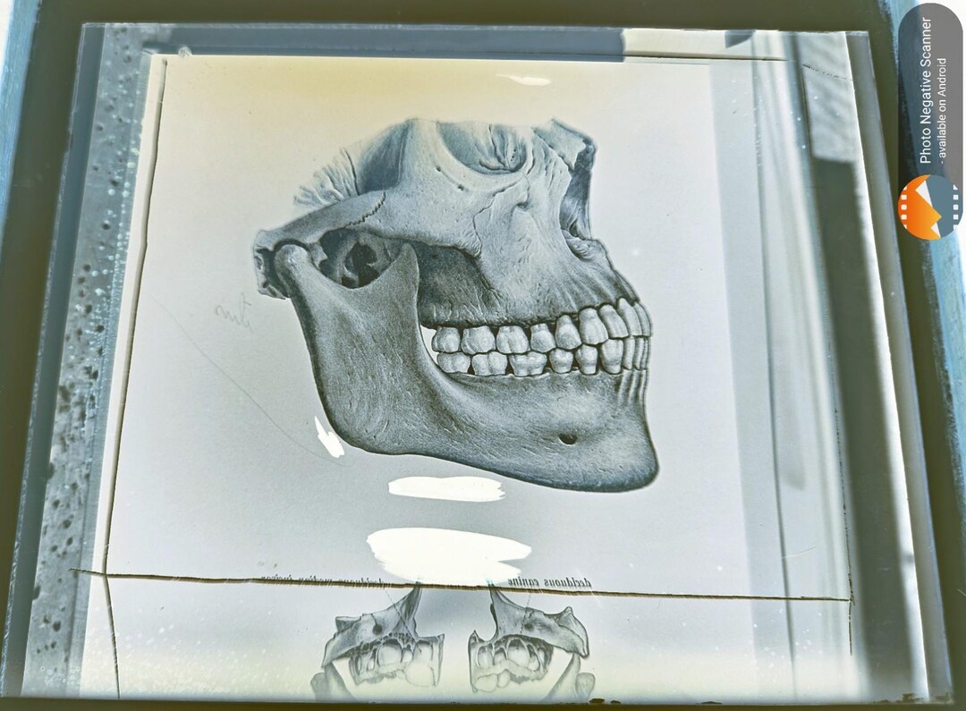 Antique Glass Plate Negative Skull Dental Xray - Etsy