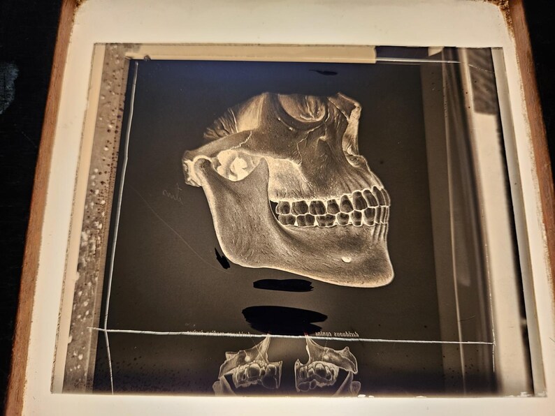 Antique Glass Plate Negative Skull Dental Xray - Etsy