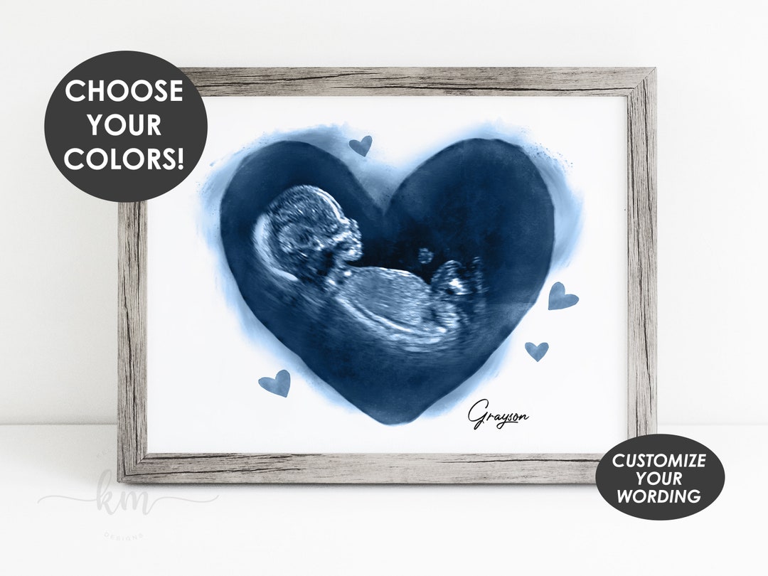 Custom Watercolor Ultrasound Art, Father's Day Gift, Heart Sonogram ...