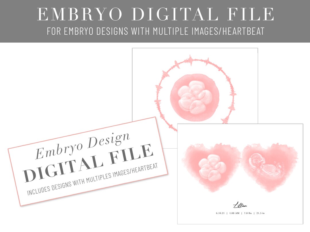 DIGITAL FILE for Embryo + Ultrasound Design or 3 Ultrasounds, Custom ...