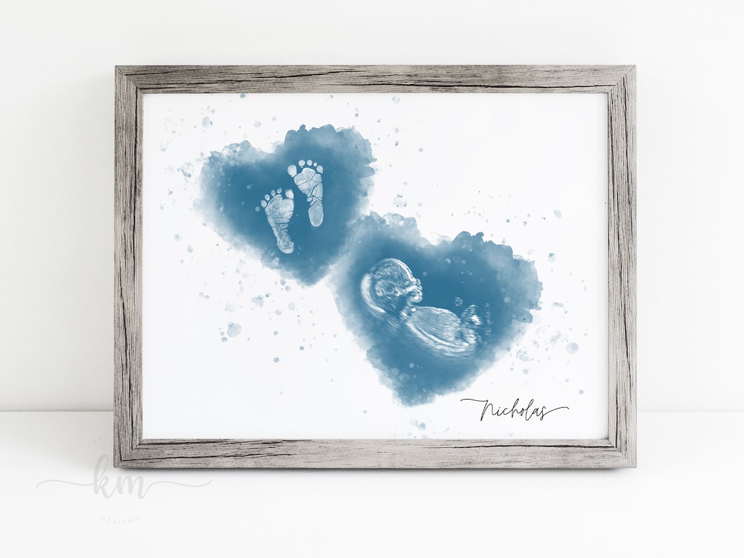 Baby Footprint Art, Watercolor Ultrasound Gift, Newborn Footprints ...