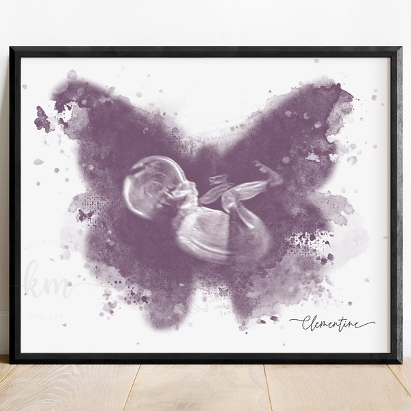 Baby Loss Ultrasound Keepsake - Etsy