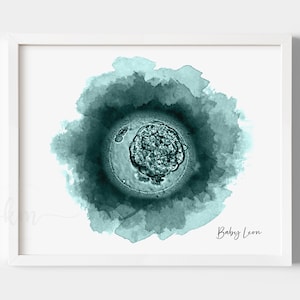 IVF Embryo Art, Watercolor Fertility Print, Baby Keepsake Art, Custom ...