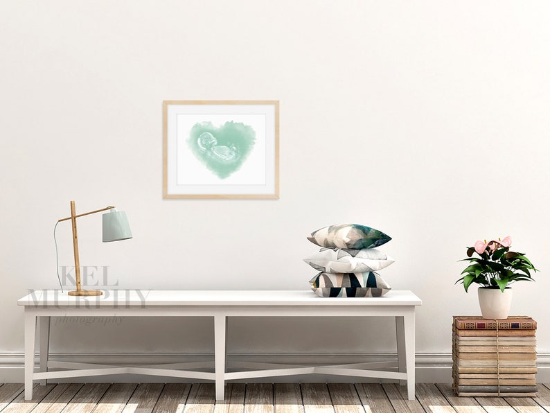 Ultrasound DIGITAL FILE Single Image Designs Custom Baby | Etsy