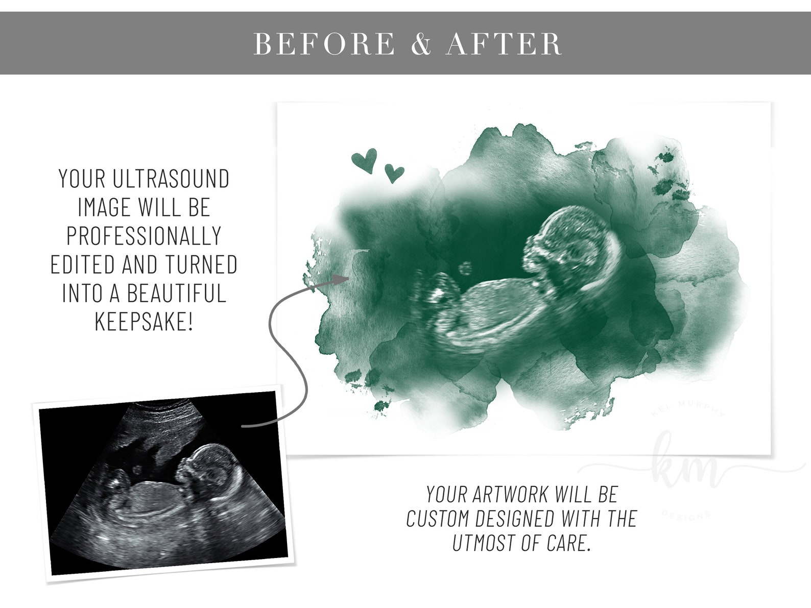 Baby Ultrasound Art Watercolor Sonogram Print Baby Shower - Etsy