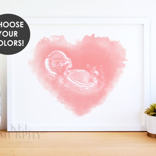Baby 3D Ultrasound Art Watercolor Sonogram Print - Etsy