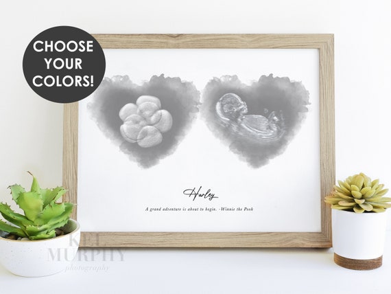 Custom IVF Embryo Art Ultrasound Watercolor Heart Sonogram | Etsy