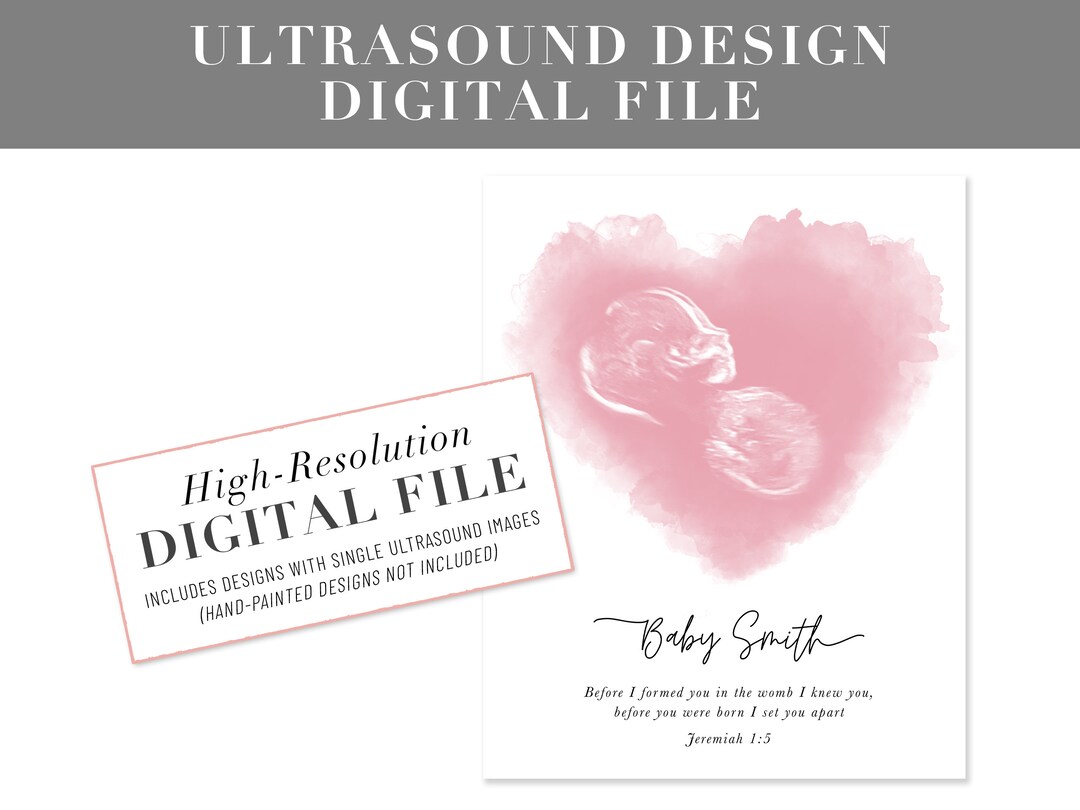 Ultrasound DIGITAL FILE - Single Image Designs! Custom Baby Sonogram ...