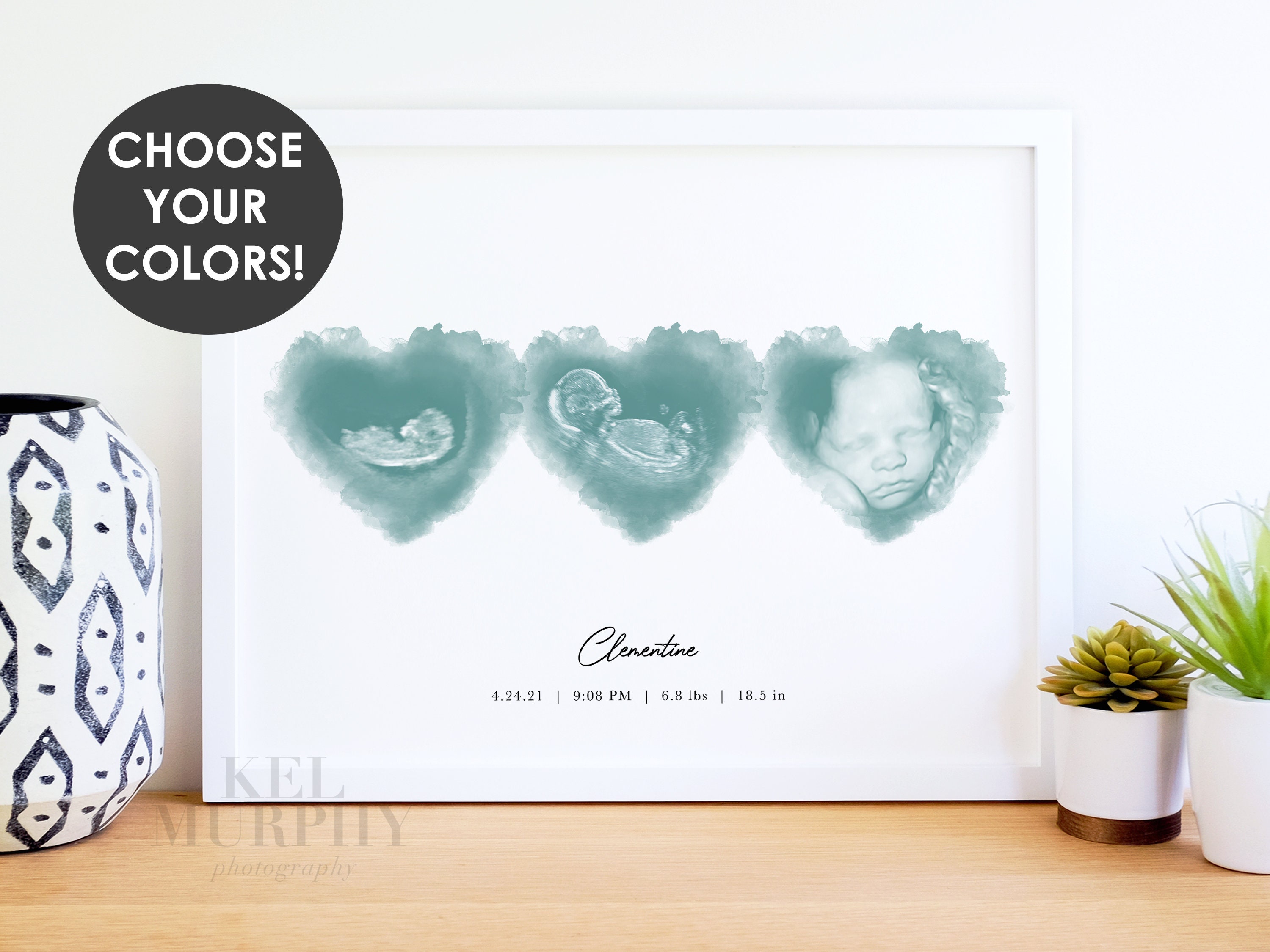 Ultrasound DIGITAL FILE Multiple Image Designs or Heartbeat | Etsy