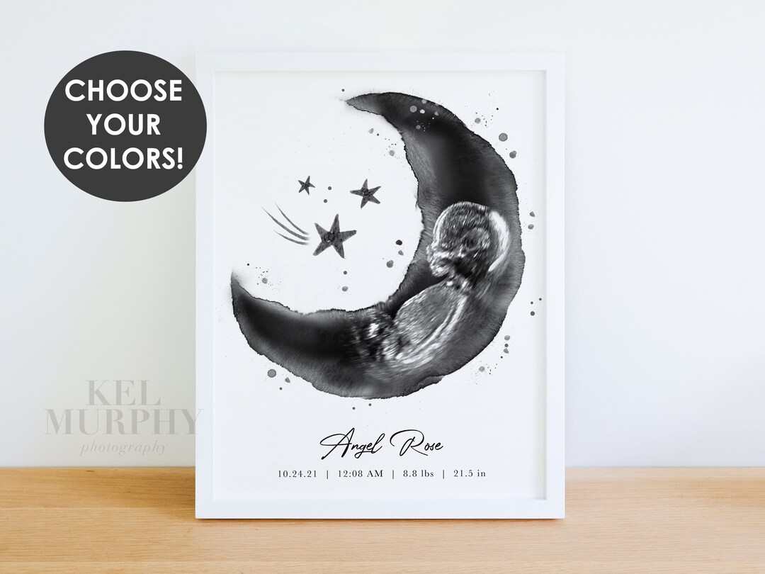Moon Ultrasound Art Print Stars Watercolor Sonogram - Etsy