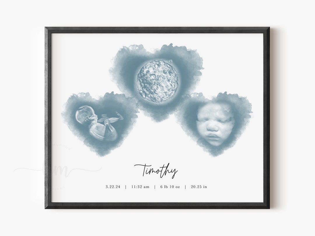 Baby IVF Embryo and Ultrasound Art, Heart Watercolor 2D 3D Sonogram ...