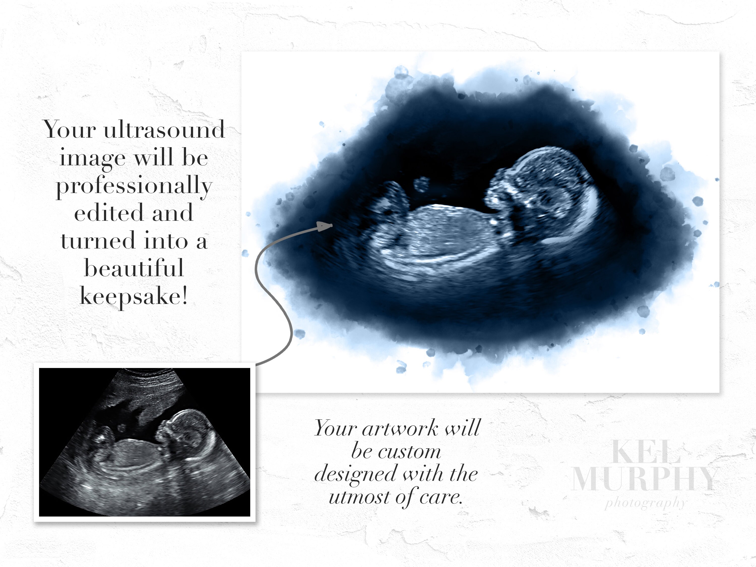 Watercolor Ultrasound Art Print Personalized Sonogram Custom | Etsy