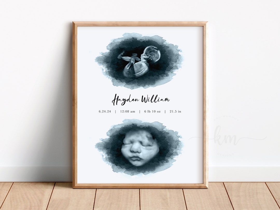 Watercolor Ultrasound Art, Sonogram Print, Baby Shower Gift, Gender ...