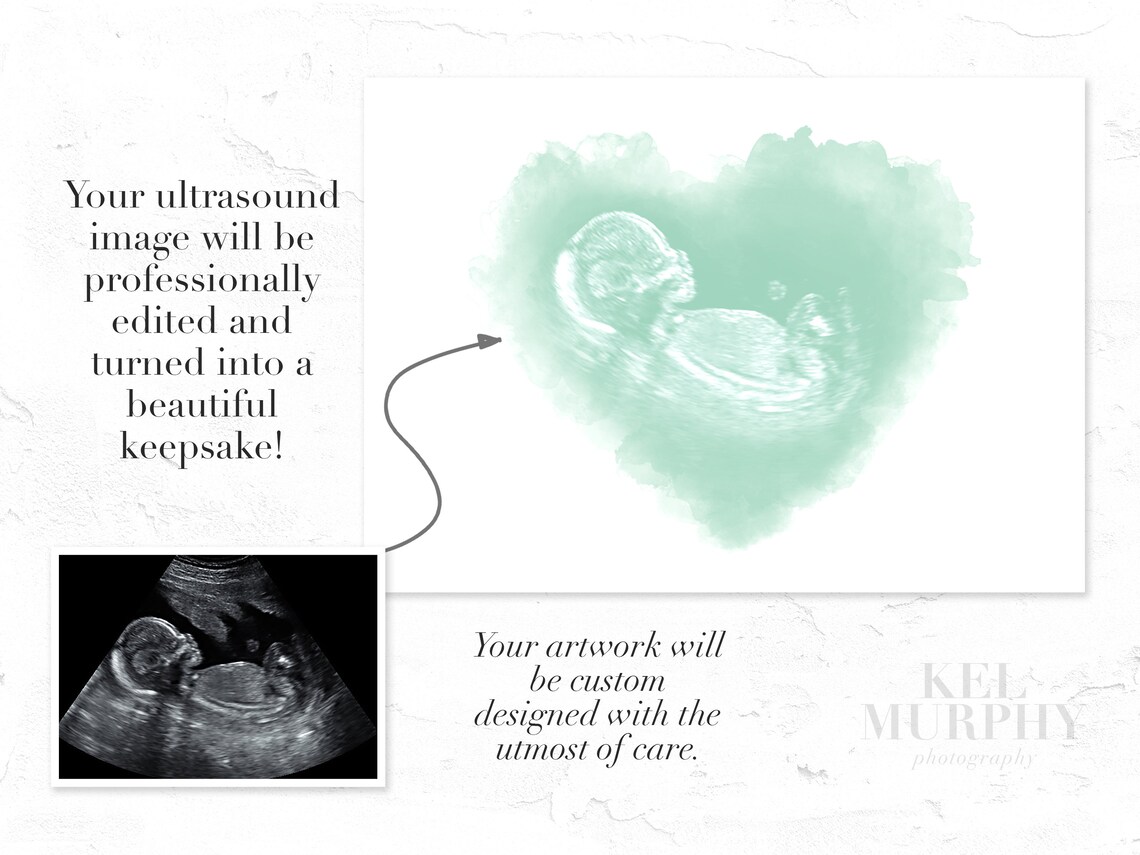 Ultrasound DIGITAL FILE Multiple Image Designs or Heartbeat - Etsy