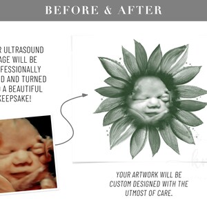 3D Ultrasound Art, Sunflower Watercolor Sonogram Print, Custom Baby ...
