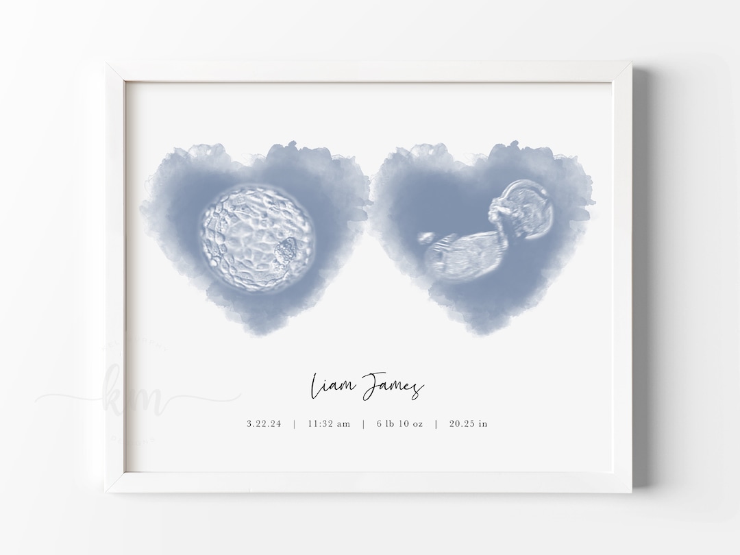 Custom IVF Embryo Art Sonogram Watercolor, Heart Ultrasound Print ...